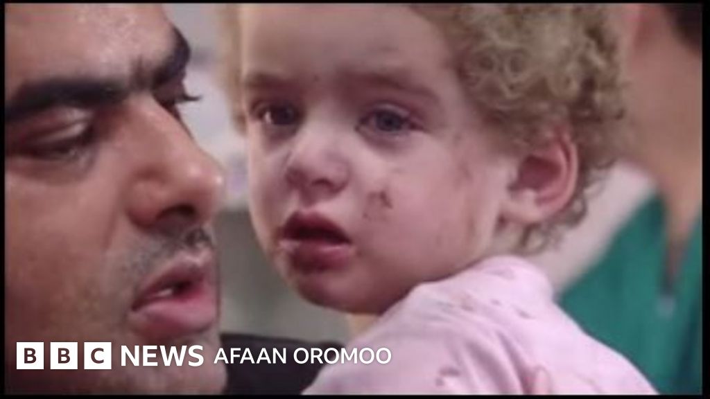 Gaaxzaatti konkolaataa daa'ima madoofte hospitaalaatti fiigsisaa jiru ...