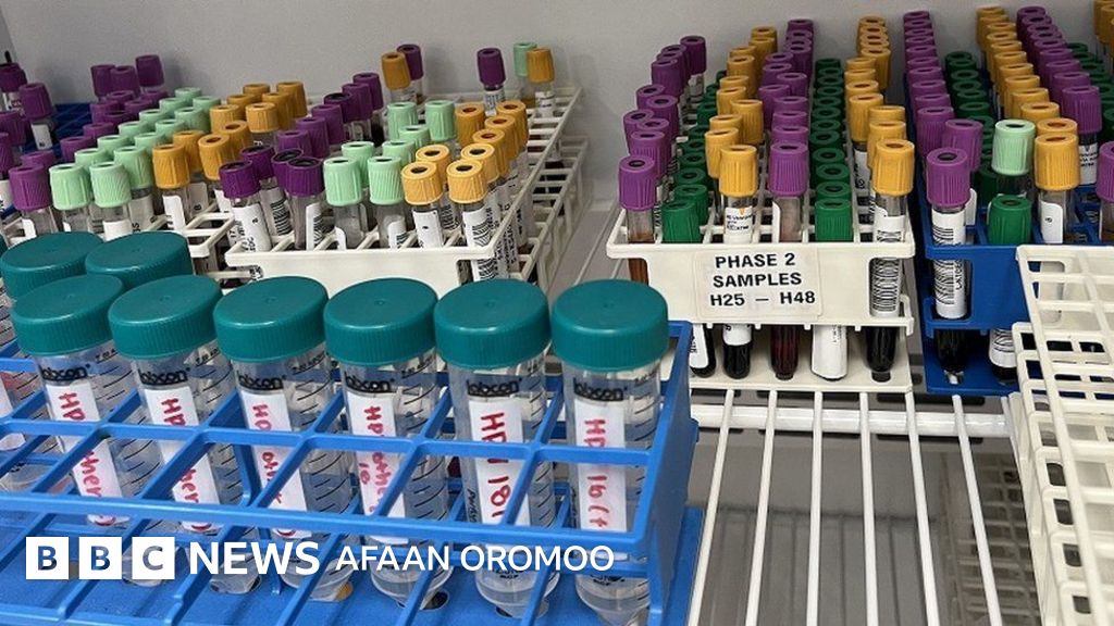 Samuuda laguu qorachuun odeeffannoo fayyaa murteessaa kennuu mala - BBC ...