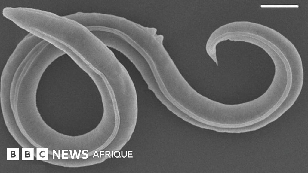 Biologie : Les vers qui ont repris vie après avoir été congelés pendant ...