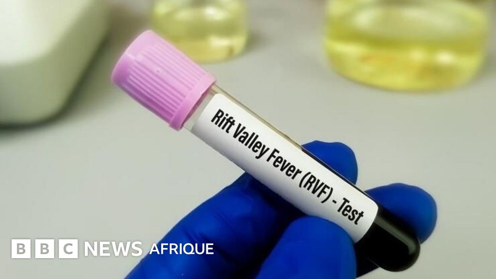 Fièvre de la Vallée du Rift au Sénégal : 25 morts et 287 cas confirmés ...