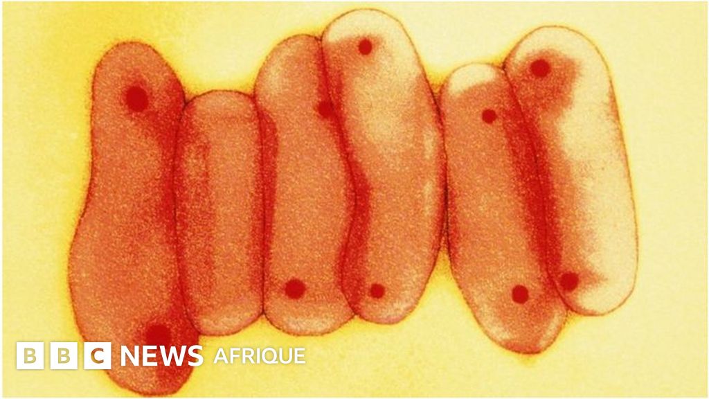 Quand va-t-on éradiquer la tuberculose ? - BBC News Afrique
