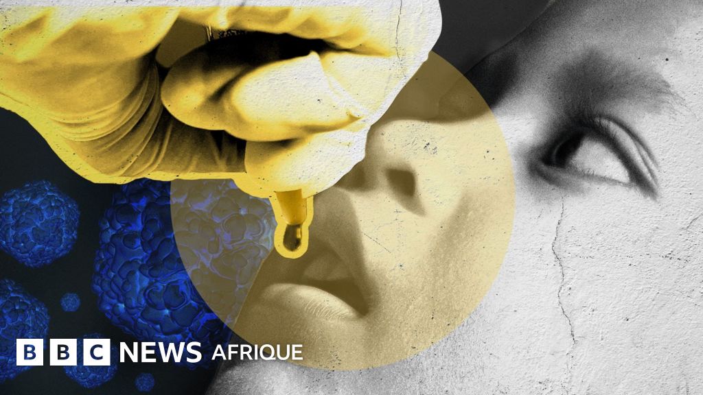 Journée mondiale de la poliomyélite : Quand le monde sera-t-il ...