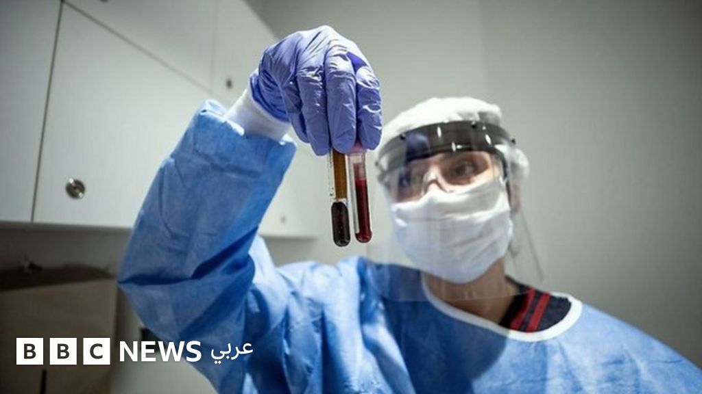 فيروس كورونا: أين وصلنا بسباق العقاقير المستخدمة للعلاج؟ - BBC News عربي