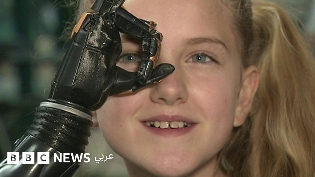 يد آلية جديدة بتقنية الطباعة ثلاثية الأبعاد Bbc News عربي