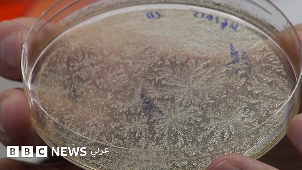 ابتكار يساعد على فهم البنية الاجتماعية للبكتيريا و محاربتها Bbc News عربي