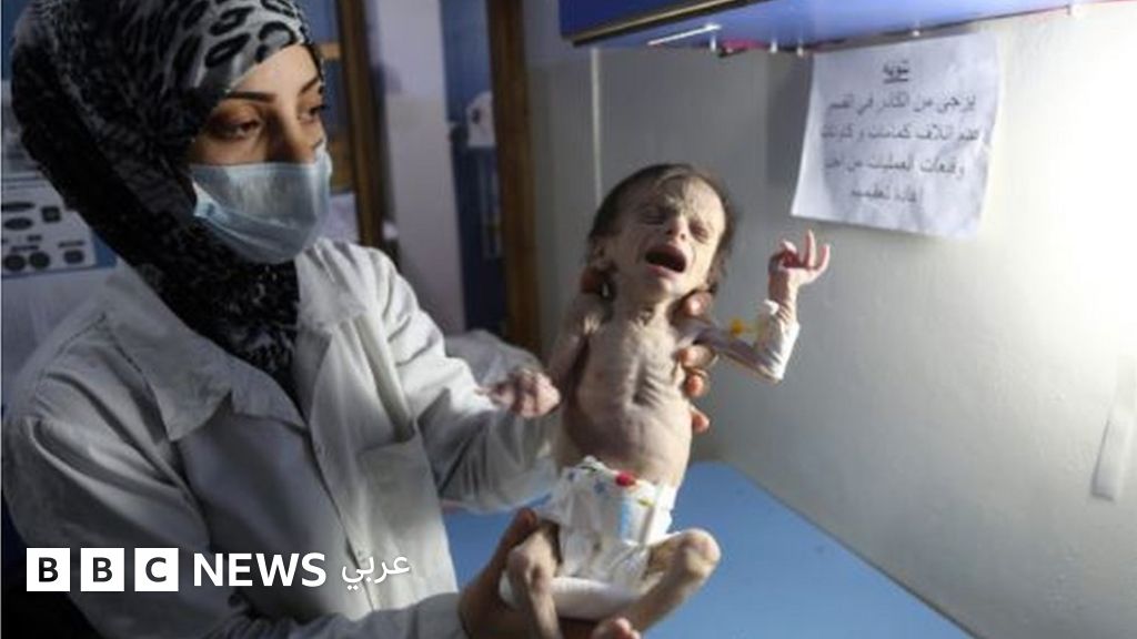سحر رضيعة سورية صدمت العالم على تويتر Bbc News عربي