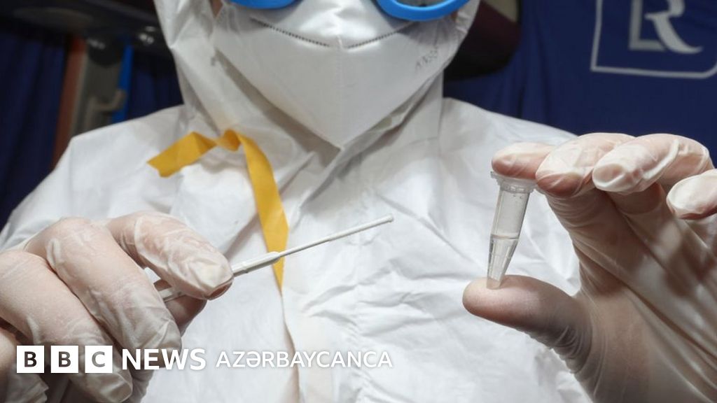 Bu günün xəbərləri: Azərbaycanda Covid-19-un "Delta" variantı ...