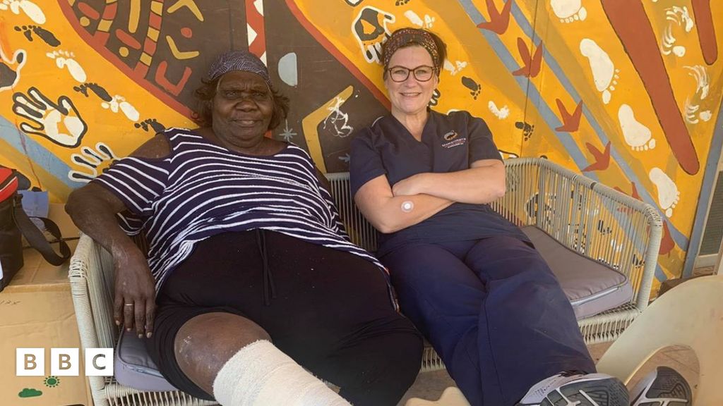 O frwydro canser i nyrsio mewn cymuned frodorol yn Awstralia - BBC ...