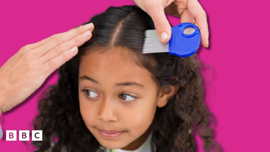 Archaeology: How nits are revealing secrets about ancient humans - BBC ...