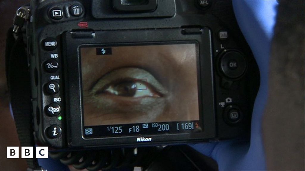 NHS project tackles diversity of skin tones in medical photos - BBC ...