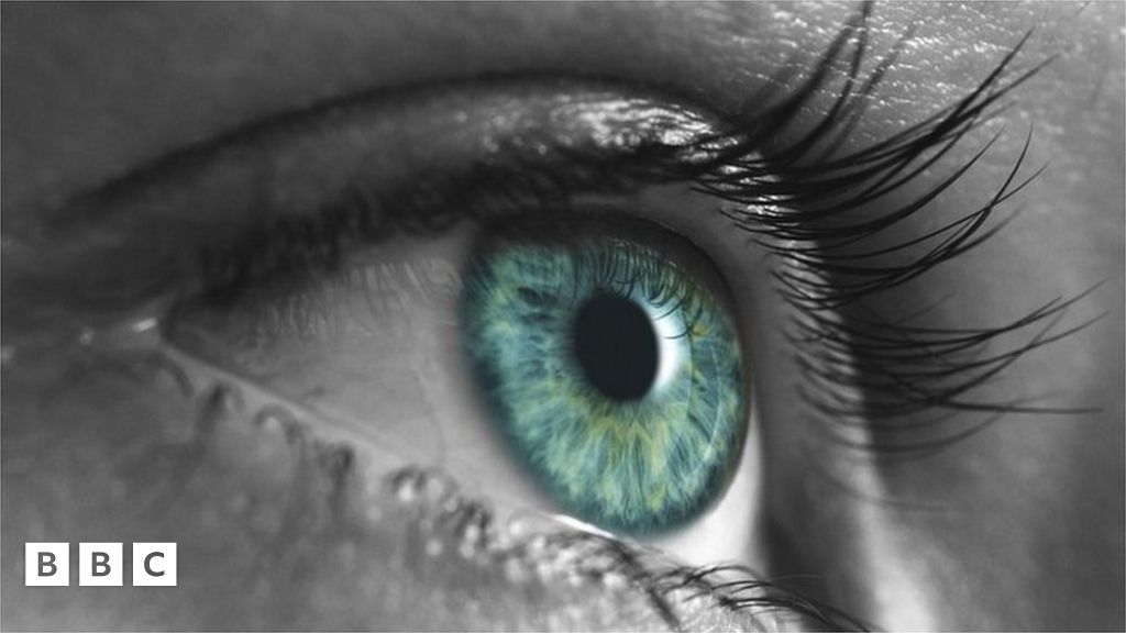 Perygl i filoedd golli eu golwg tra'n disgwyl triniaeth - BBC Cymru Fyw