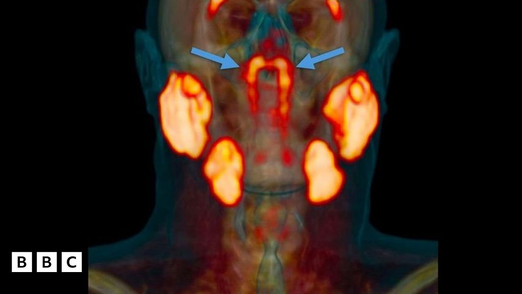 Have doctors uncovered a secret part of the body? - BBC Newsround