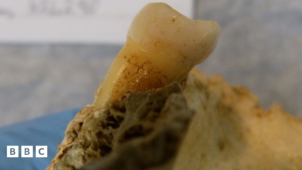 Ancient cavity-creating bacteria found in Bronze Age teeth - BBC Newsround