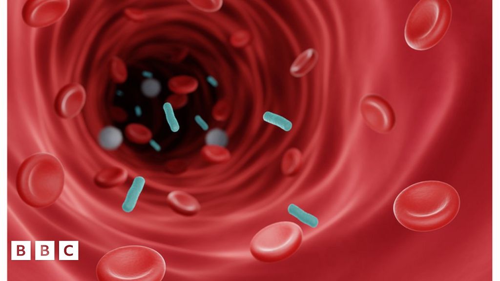 World Sepsis Day: What is sepsis? What are the symptoms? - BBC Newsround