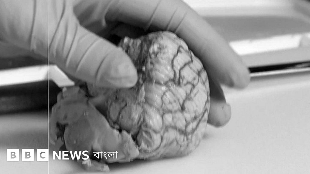 ডেনমার্ক কেন ১০ হাজার মানুষের মস্তিষ্ক সংরক্ষণ করে রেখেছে - BBC News বাংলা