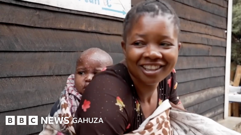 Mpox: ibitaro vya Kavumu – Bukavu bifise igice cuzuye abana - BBC News ...