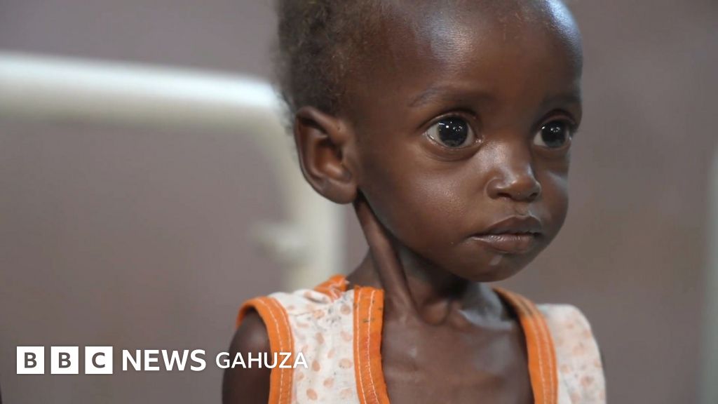 Sudan: ibibera mu bitaro bifasha abishwe n’inzara - BBC News Gahuza