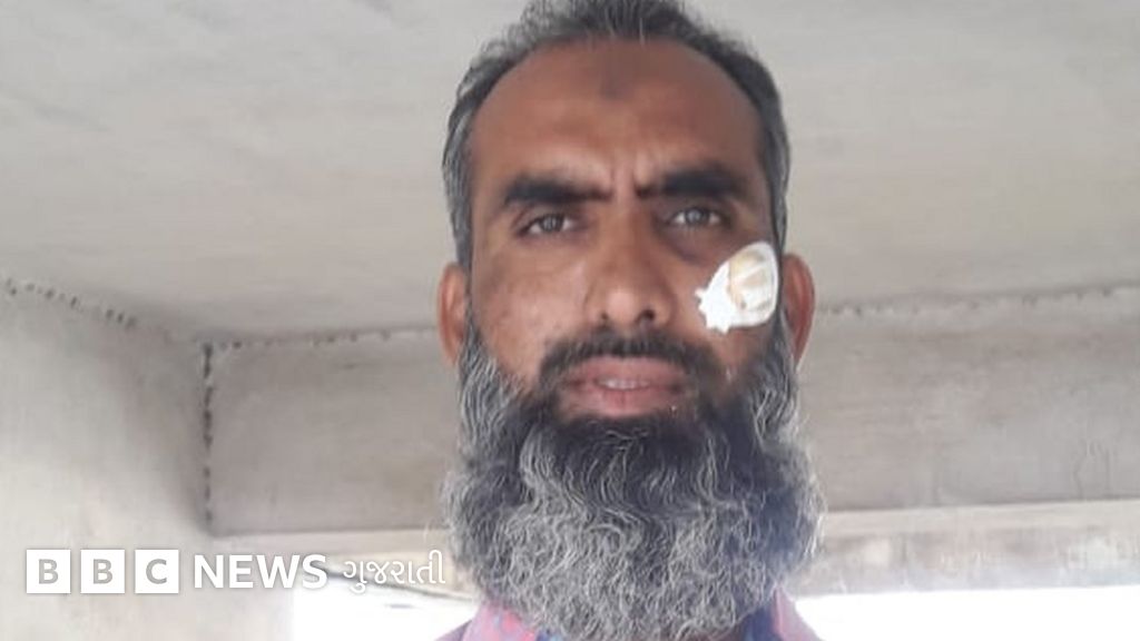 વડોદરા : મુસ્લિમ પોલીસમૅનને દાઢી ખેંચી માર મરાયો, પાંચની ધરપકડ - BBC ...