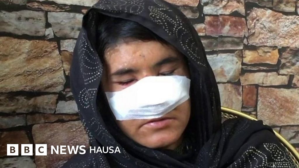 ‘Mijina ne ya sa wuka ya yanke hancina’ - BBC News Hausa