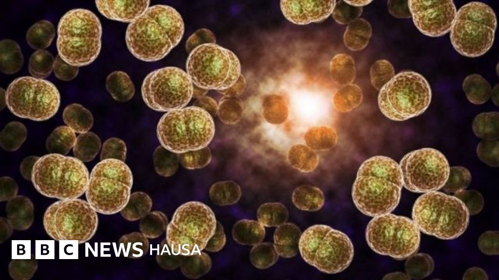 Shin rashin tsafta ne ke haifar wa mata ciwon sanyi a al'aura? - BBC ...