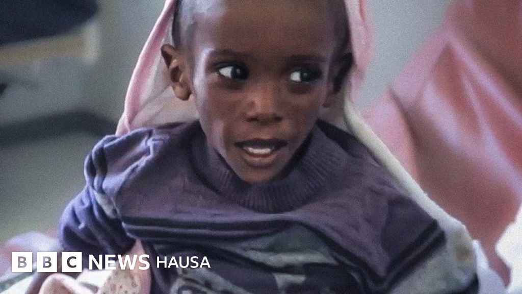 Yaron da aka sanya wa suna ‘Attajiri’ wanda nauyinsa bai wuce rabin ...