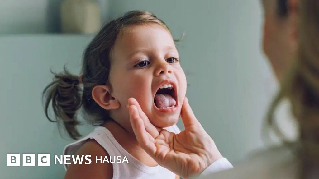 Taimakon da ya kamata a yi wa yaron da ya ƙware - BBC News Hausa