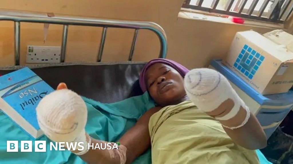 'Yadda mijina ya datse min hannu da wuƙa' - BBC News Hausa