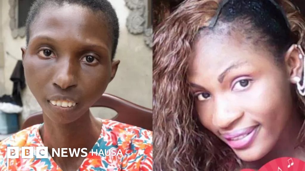 'Ba na son duba madubi saboda yadda na sauya daga zankaɗeɗiyar budurwa ...