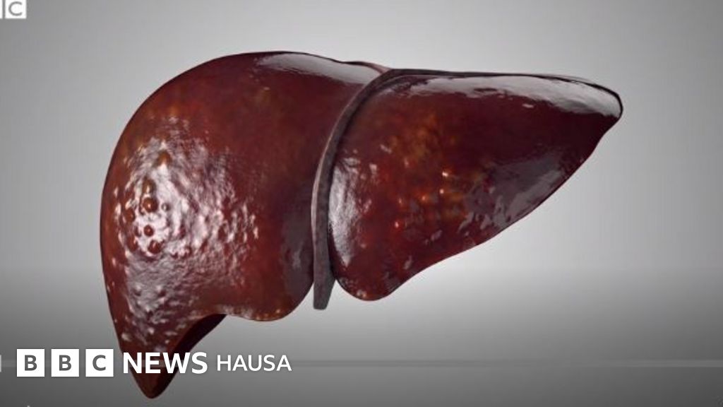 Yaya zan kare kaina daga ciwon hanta? - BBC News Hausa