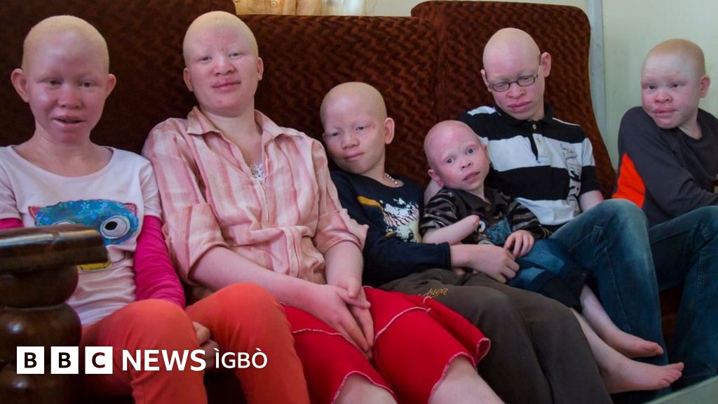International Albinism Awareness Day: Lee nke bụ eziokwu na nghọtaghie ...