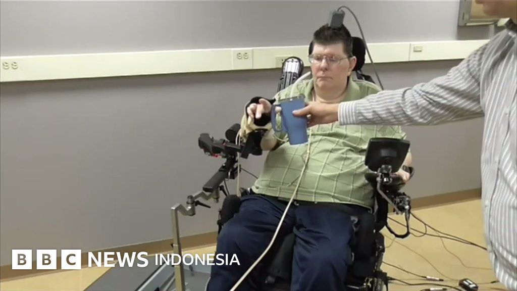 Penderita lumpuh bisa kembali bergerak berkat implan di otaknya - BBC ...