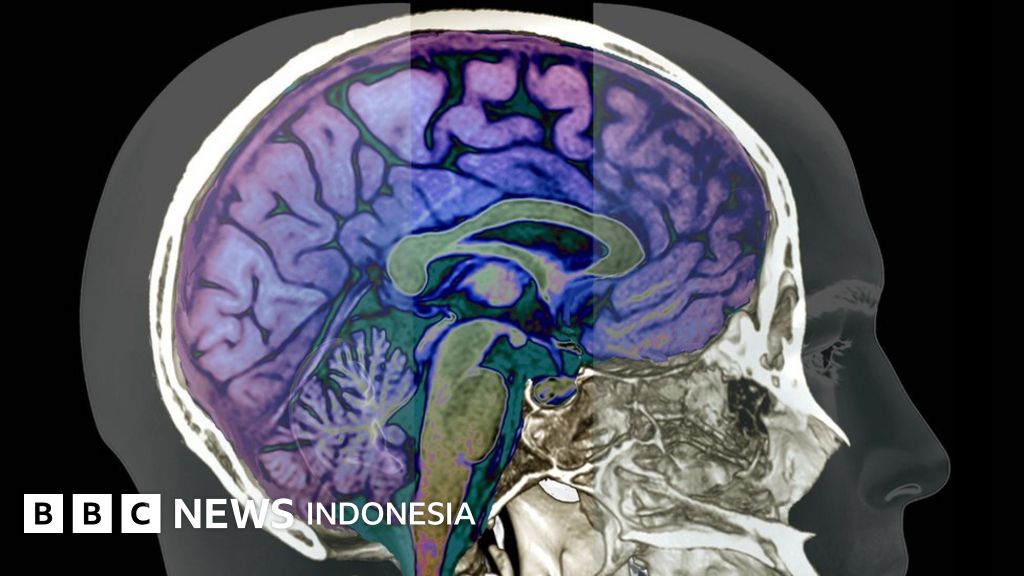 Otak manusia lebih besar 3000 tahun yang lalu, mengapa menyusut? - BBC ...