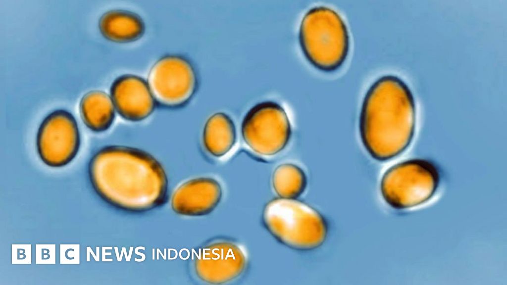 Candida auris: 'Kuman super' melanda rumah sakit di AS - Apa itu jamur ...