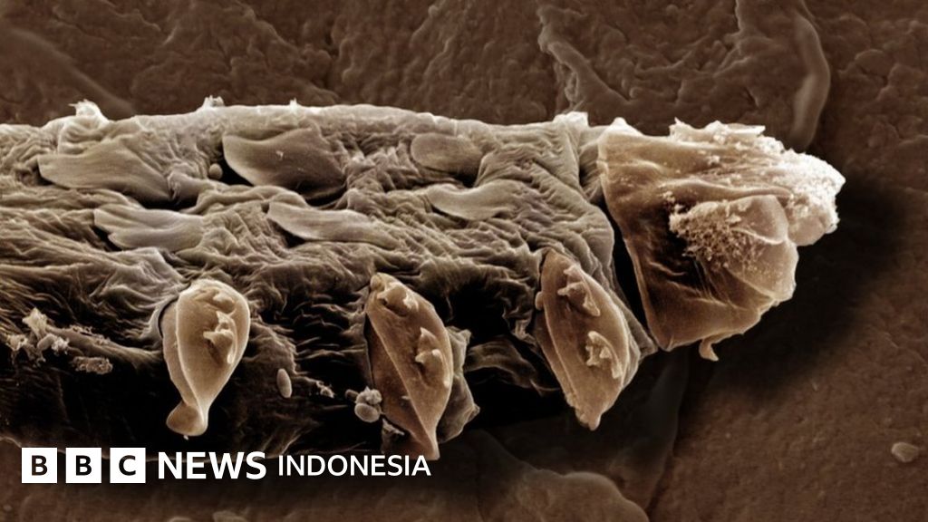 Tungau yang bercinta di kulit wajah kita sedang menghadapi masalah ...