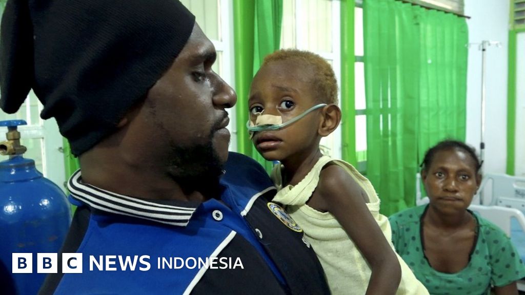 Melihat anak-anak di Asmat yang dilanda wabah campak dan gizi buruk - BBC News Indonesia