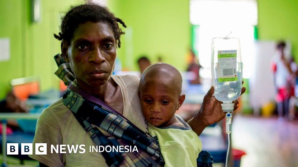 Pemerintah Indonesia mengaku kesulitan tangani wabah kelaparan di Asmat - BBC News Indonesia