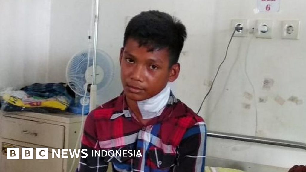 Moncong ikan marlin menembus leher remaja asal Buton: 'Sakit sekali ...