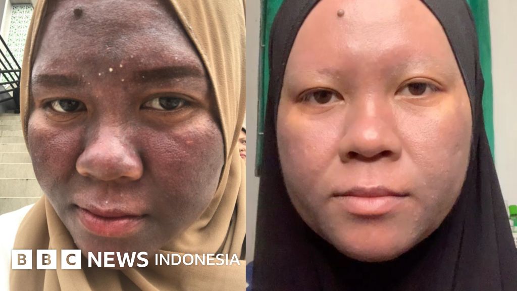 Skincare: Peredaran kosmetik ilegal dengan bahan berbahaya yang ‘susah ...