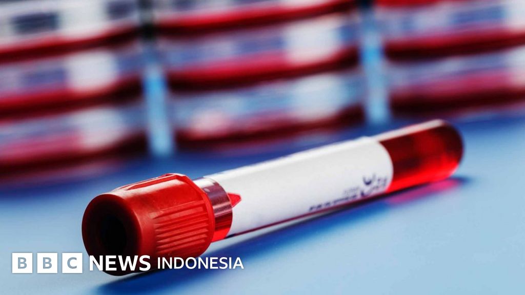 Obat Covid 19 Temuan Baru Soal Kekebalan Tubuh Munculkan Harapan Dalam