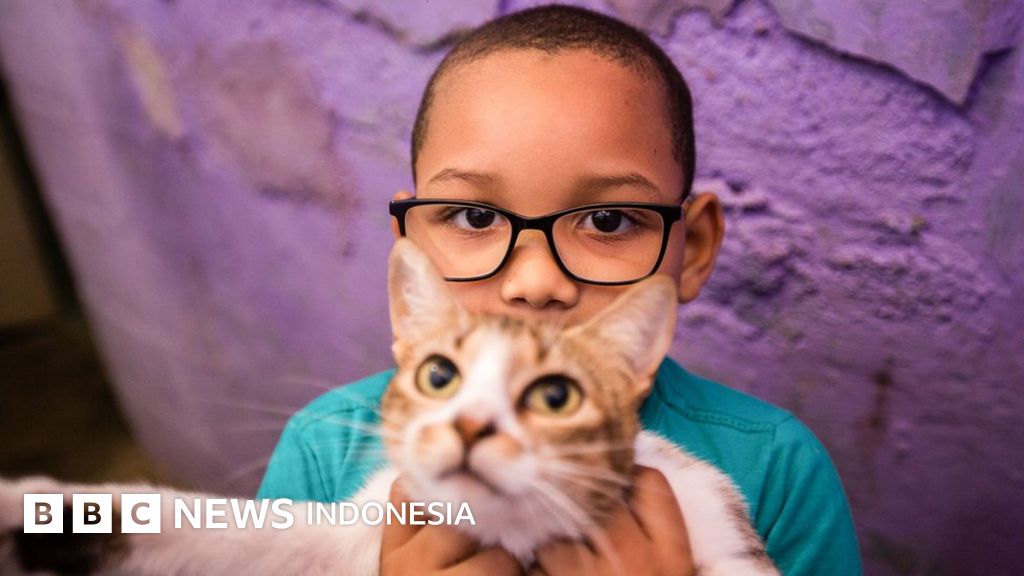 Dampak pandemi Covid-19 bagi anak-anak penderita virus zika: Gagap bicara, sulit berjalan, susah ...