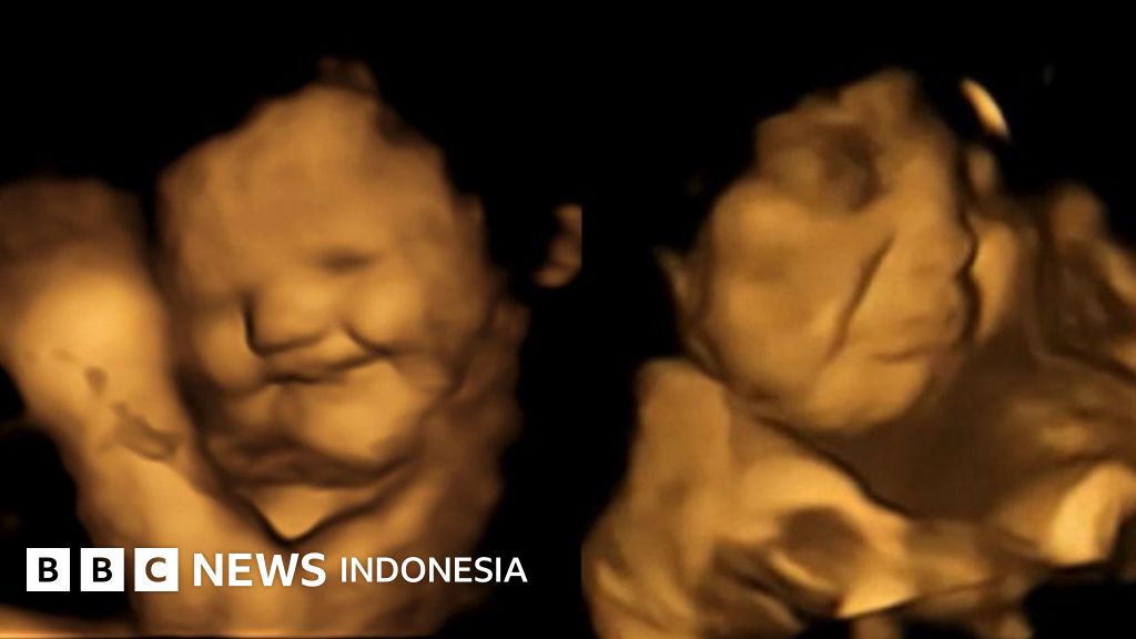 Bayi dalam kandungan 'tersenyum' ketika merasakan wortel tapi 'cemberut ...