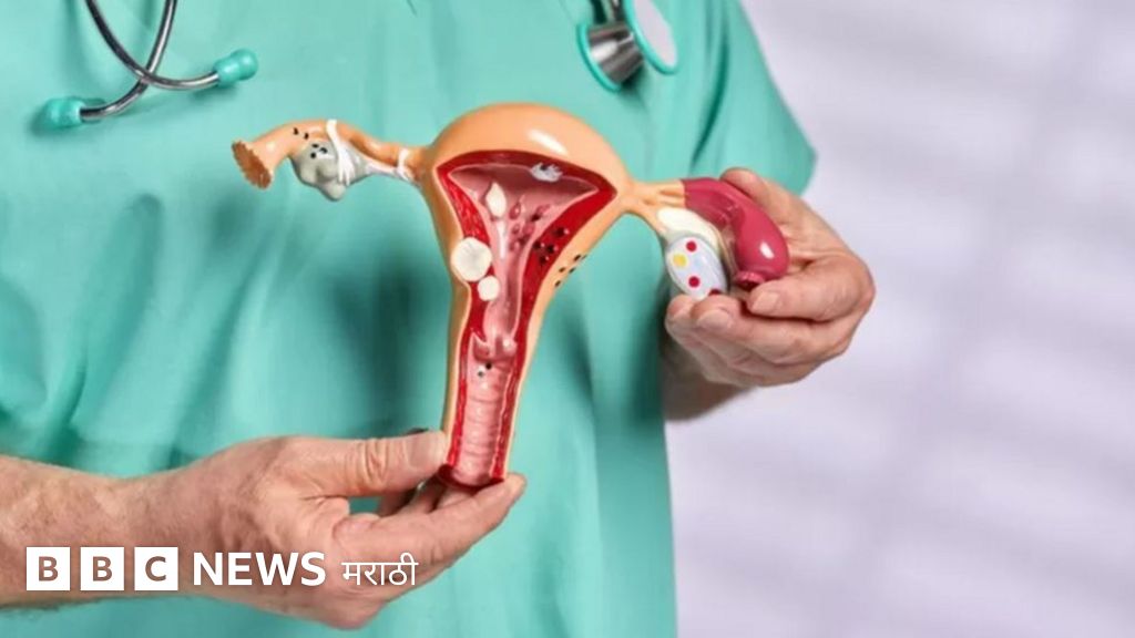 Rokitansky Syndrome: मुलींना गर्भाशय आणि योनीमार्ग नसण्याचा हा आजार ...