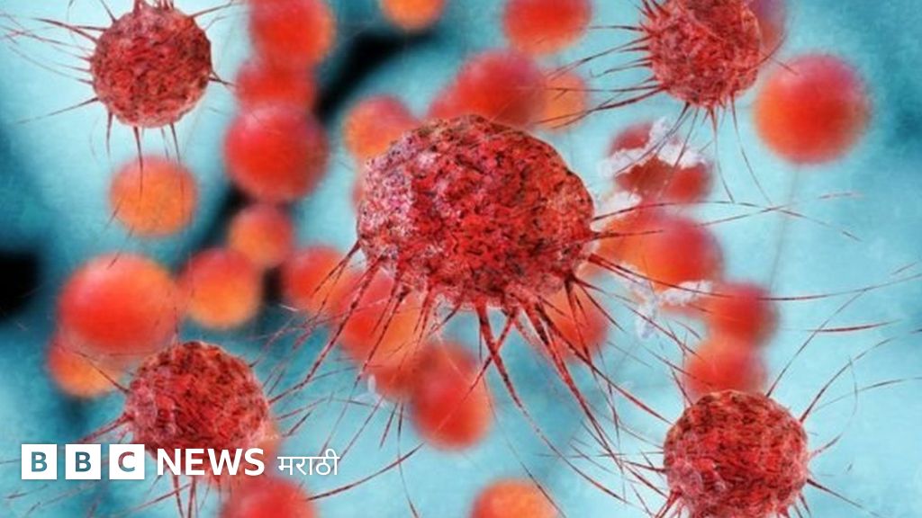 Cancer : केमोथेरपी म्हणजे काय? कॅन्सर रुग्णाला त्याचा किती फायदा होतो ...