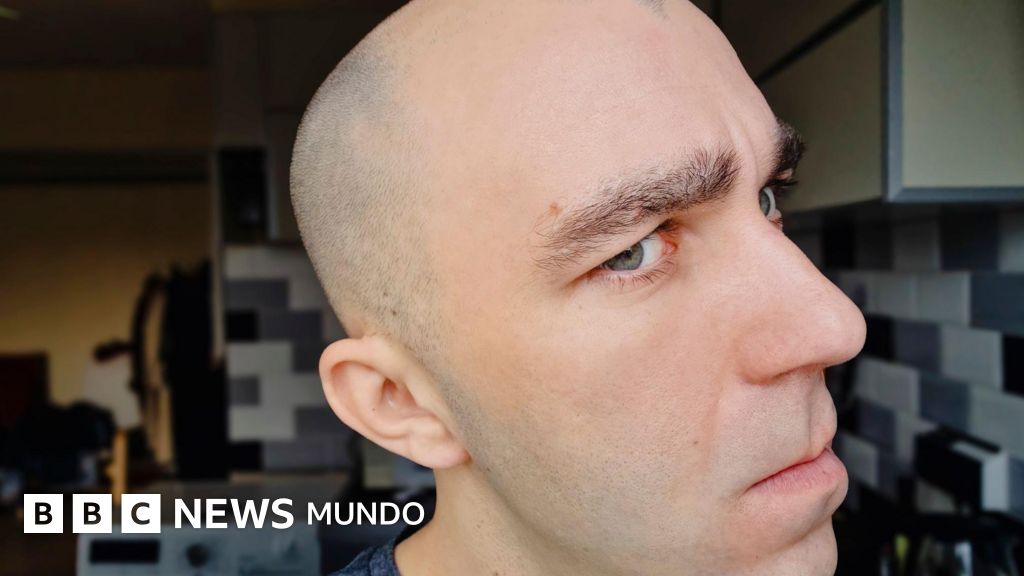 La curiosa historia de cómo la calvicie fue usada para respaldar el ...