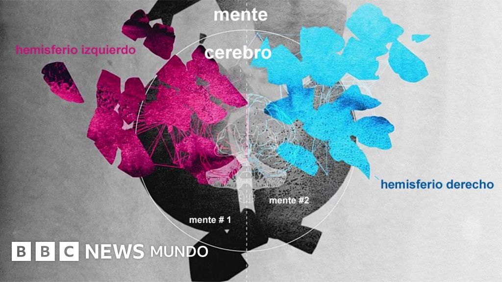 El curioso caso que llevó a descubrir que todos tenemos “dos cerebros ...