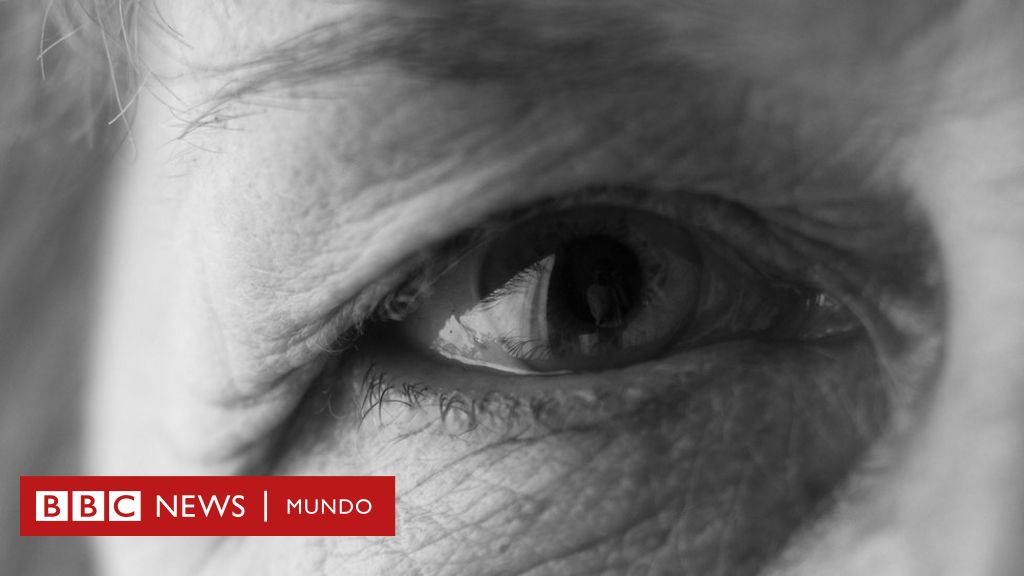 Simultanagnosia: la extraña condición de quienes no pueden ver más de ...