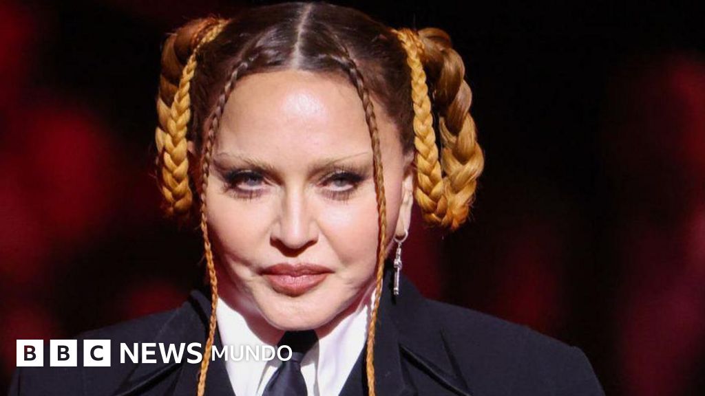 Madonna: “Tengo suerte de estar con vida” - BBC News Mundo