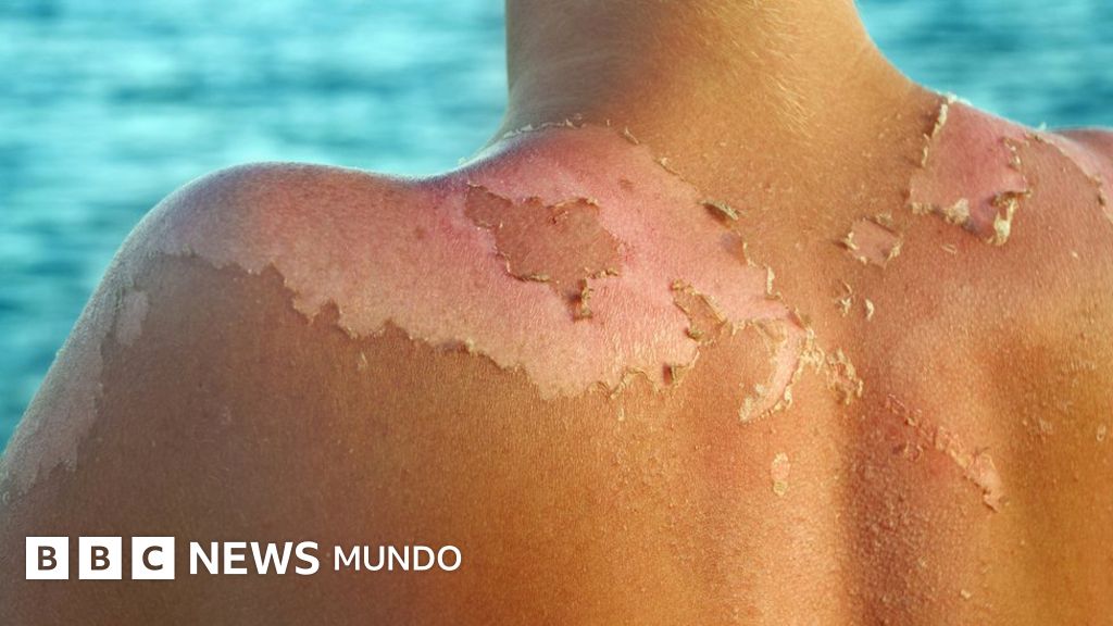 La aplicación que te dice cuánto tiempo puedes exponerte al sol sin ...