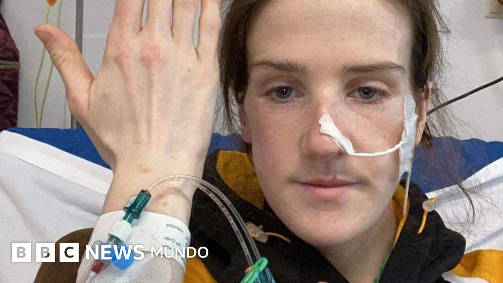 Gastroparesia: "Tenía el estómago paralizado y creyeron que sufría de ...