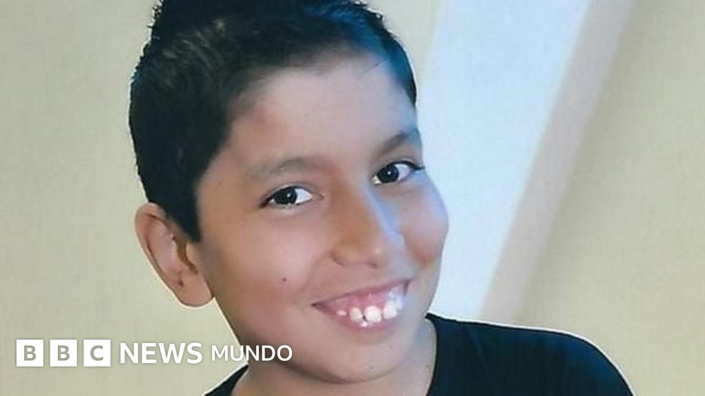 La condición extremadamente rara por la que un joven de 23 años parece ...